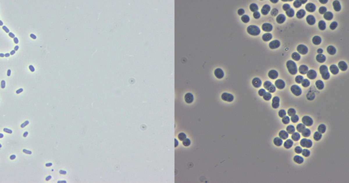 New bacterial processes in the global carbon cycle and in the ...